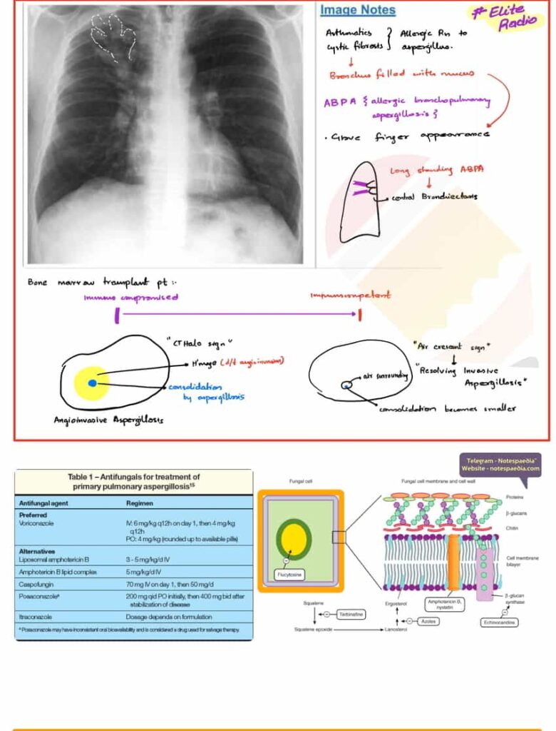 NEET PG 2020 Question Paper Discussion - Notespaedia