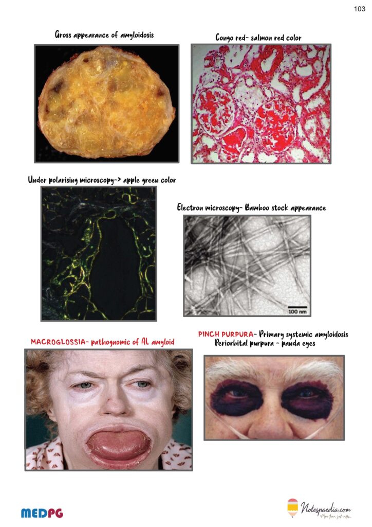 Pathology Capsule - Notespaedia