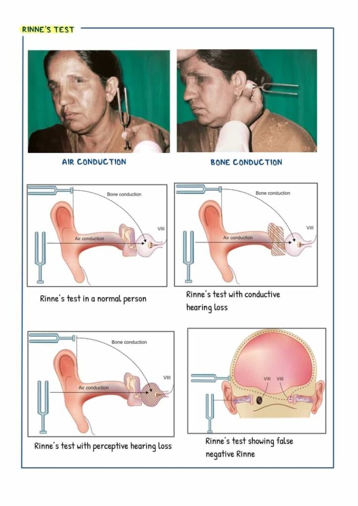 ENT Image Bank - Notespaedia