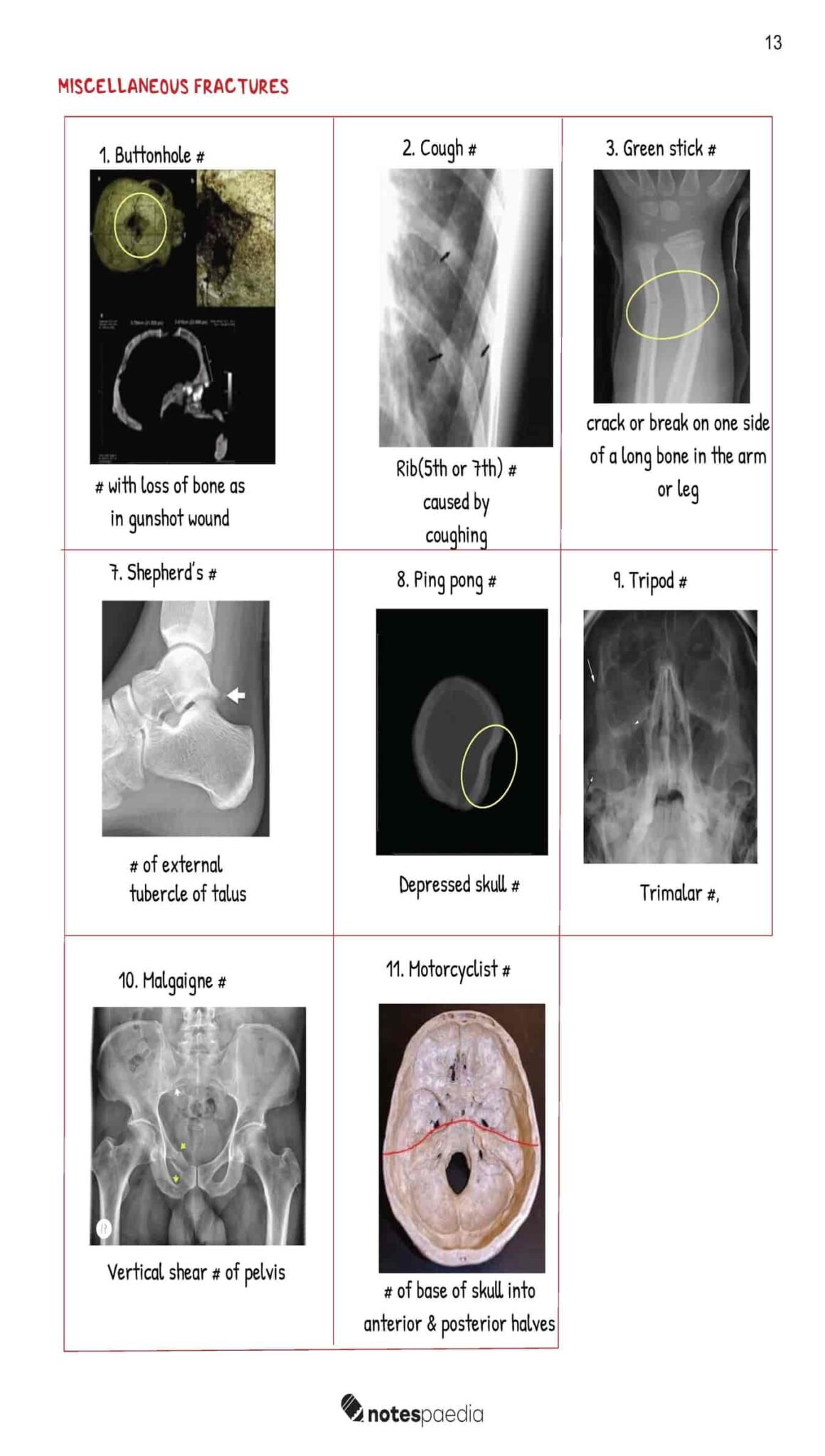Elite Orthopedics - Notespaedia
